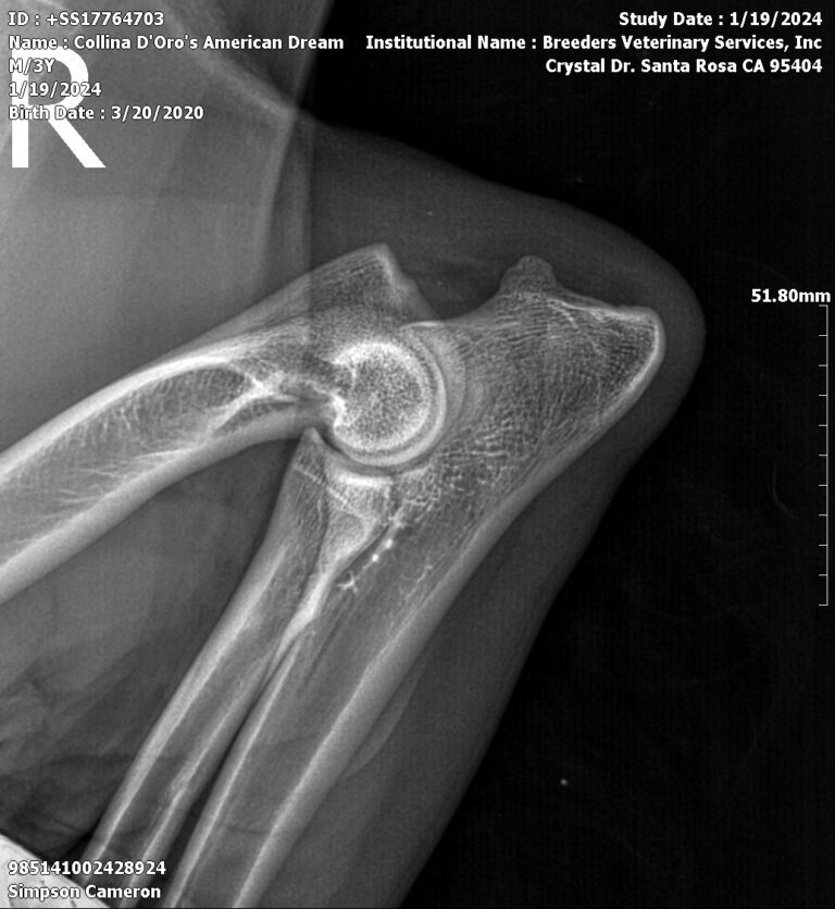 Elbow Evaluation - Resources